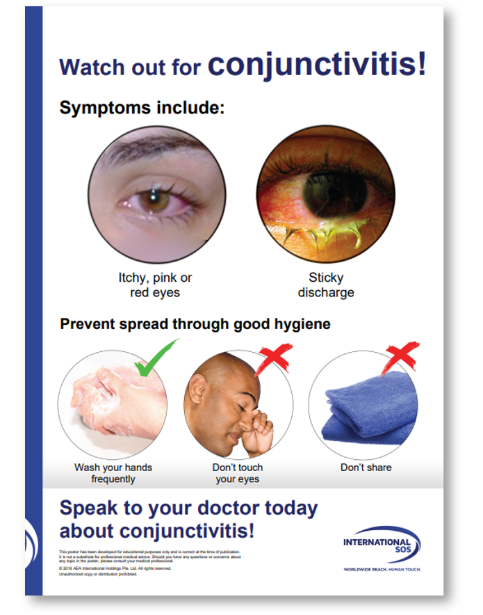 Health Information - Conjunctivitis